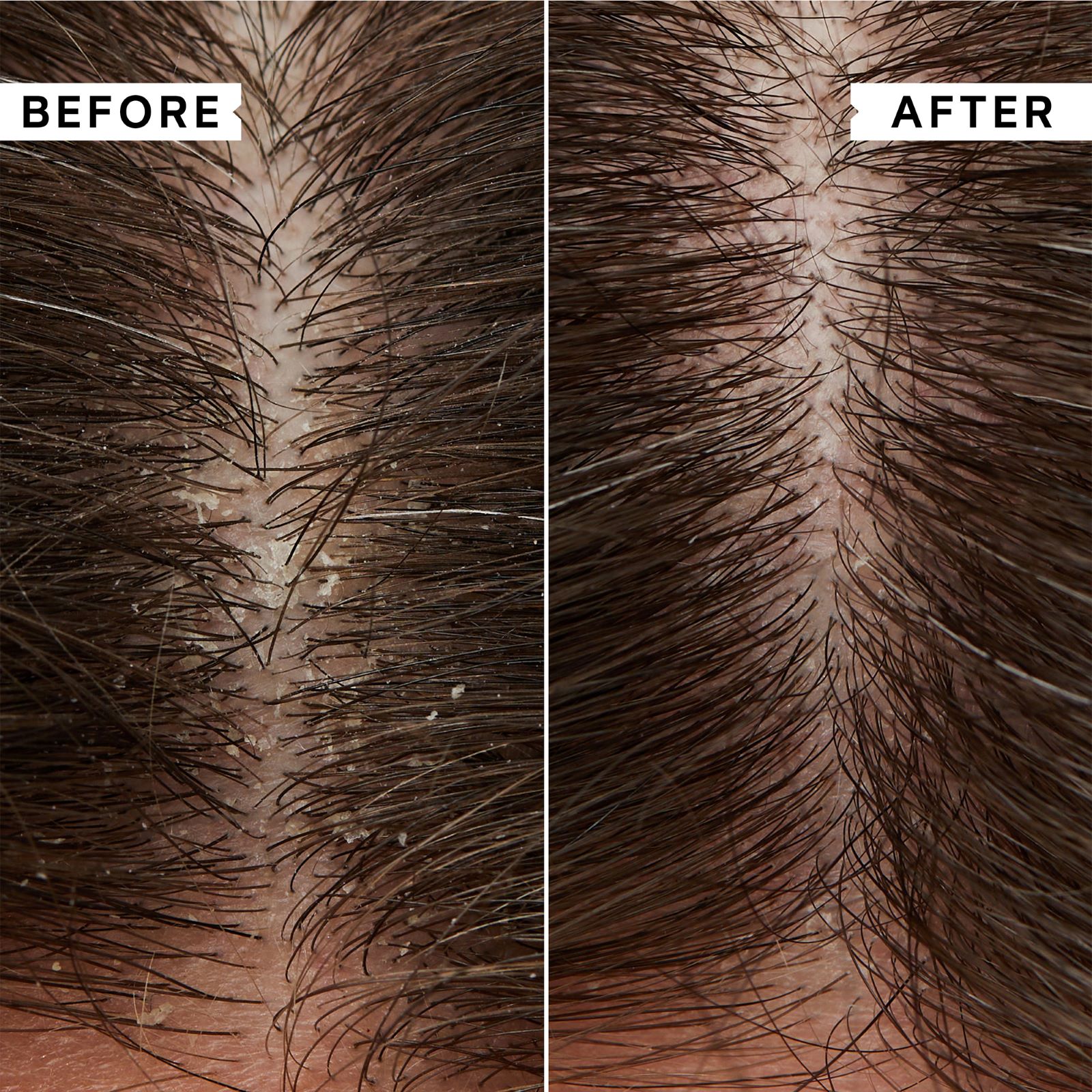 Philip Kingsley Flaky/Itchy Scalp Mask 2 x 20ml | FEELUNIQUE