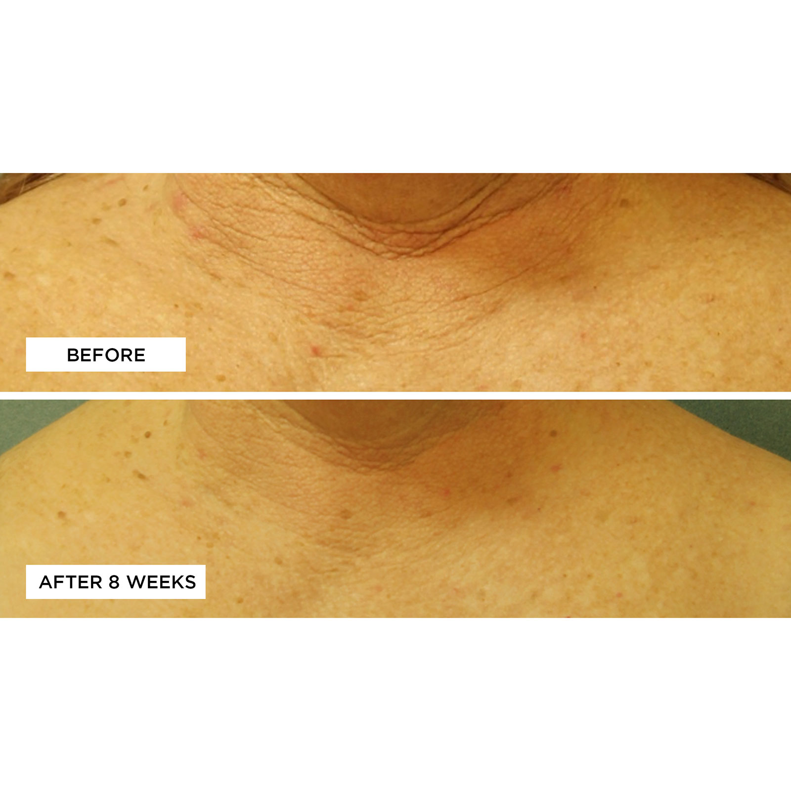 Perricone MD Cold Plasma Plus Neck & Chest SPF25 30ml | FEELUNIQUE